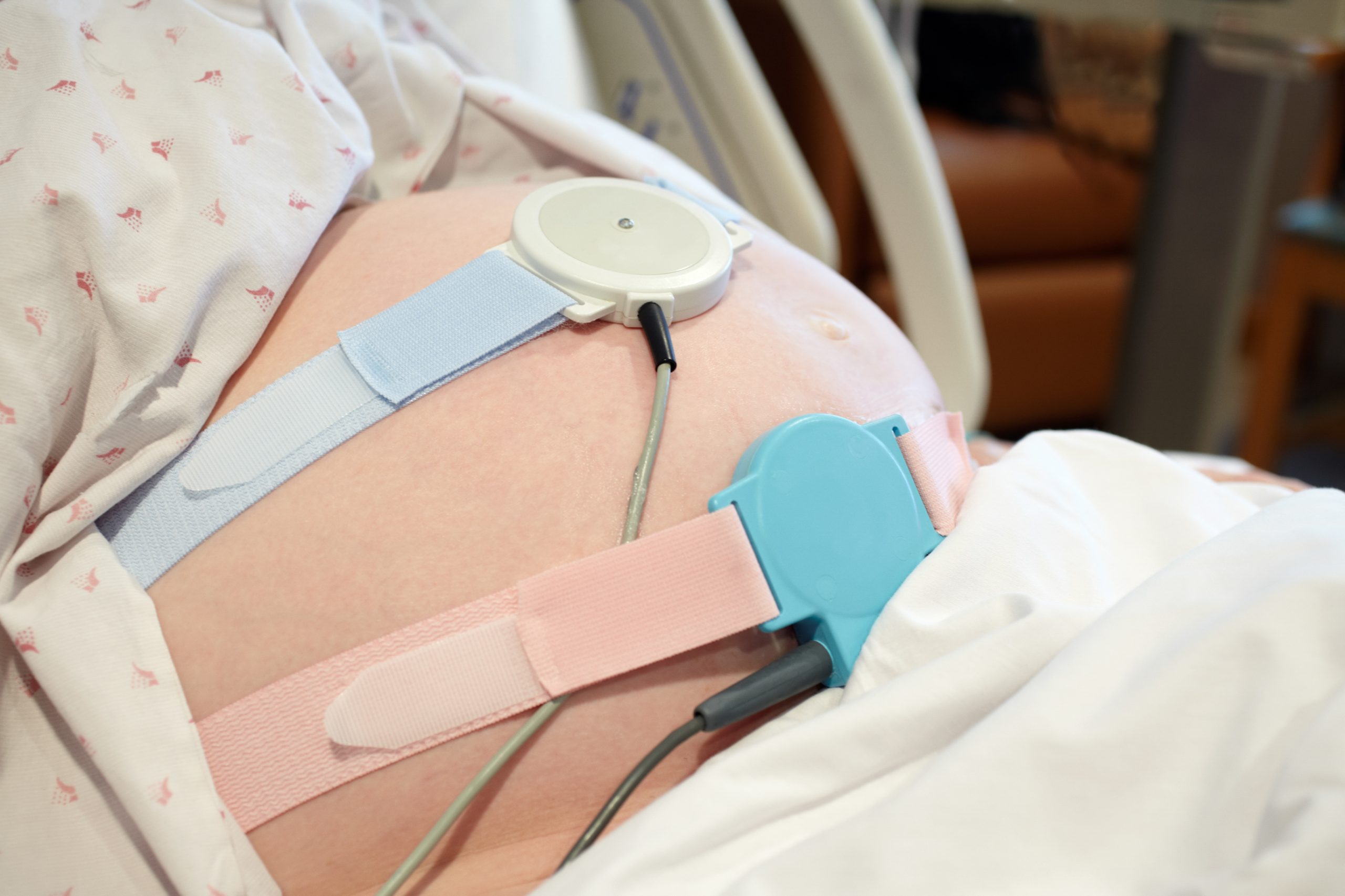 Understanding Fetal Bradycardia And HIE - HIE Resource Place